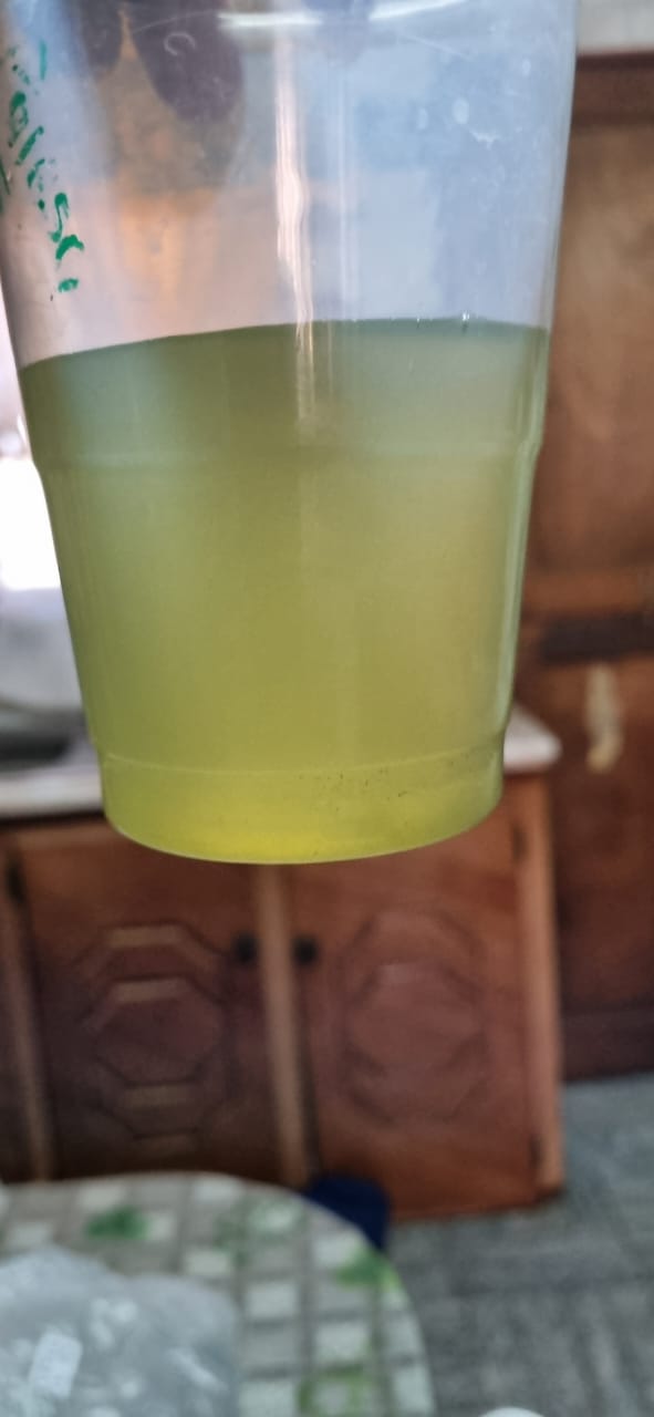 Patients at Taung District Hospital concerned due to water ...